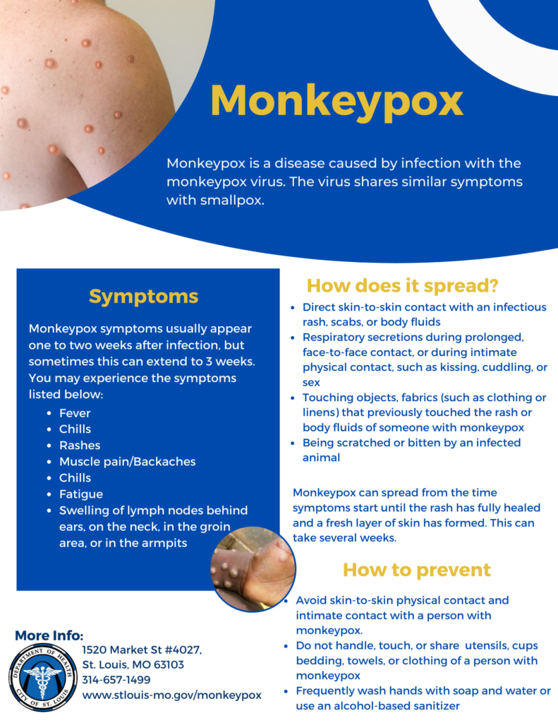 What Students Need to Know About Monkeypox on Campus - The Scholarship ...